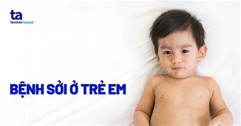 Benh Ban Do O Tre Em Sale Emergencydentistry Com