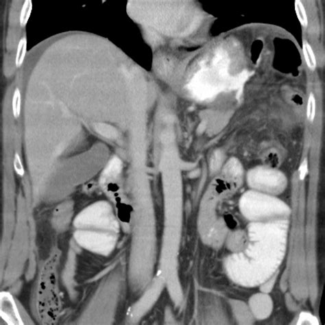 Image Radiopaedia Org