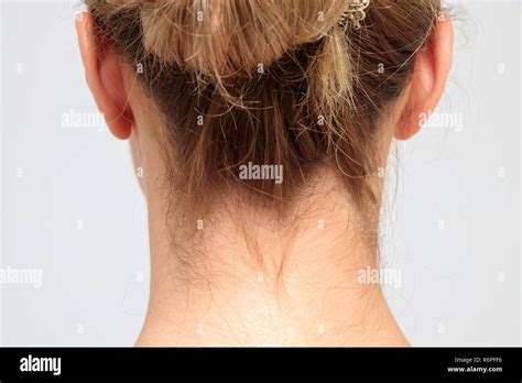 Where Is The Nape Of The Neck Where Is The Nape Located Nrtzo