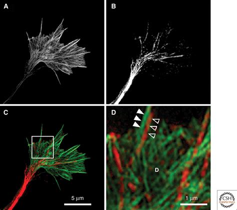 The Growth Cone Cytoskeleton In Axon Outgrowth And Guidance
