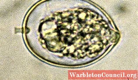Phytophthora Characteristics Species Reproduction Nutrition Science