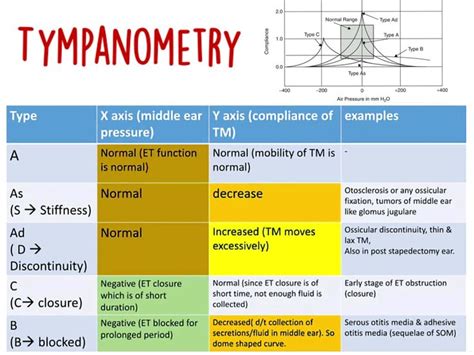 Tympanometry Types A Normal As Stiffness Ad Discontinuity C Closed B Blocked