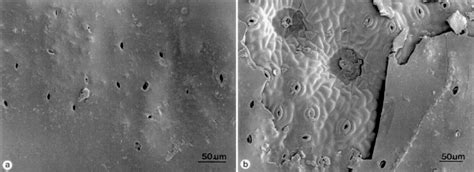Scanning Electron Micrographs Of Phyllode Surfaces A Phyllode Surface