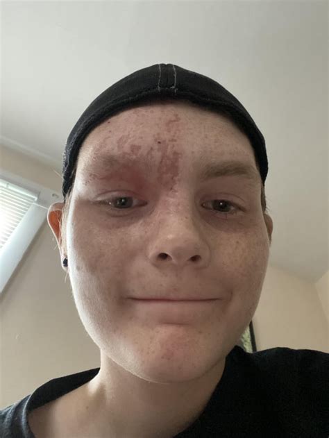 The Aftermath Rshingles