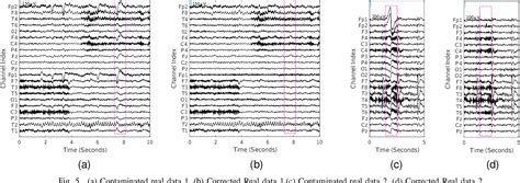 Figure 5 From Estimation Of Eog Artifacts From Eeg Signal By Orthogonal Matching Pursuit And