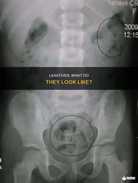 Laxatives What Do They Look Like MedShun