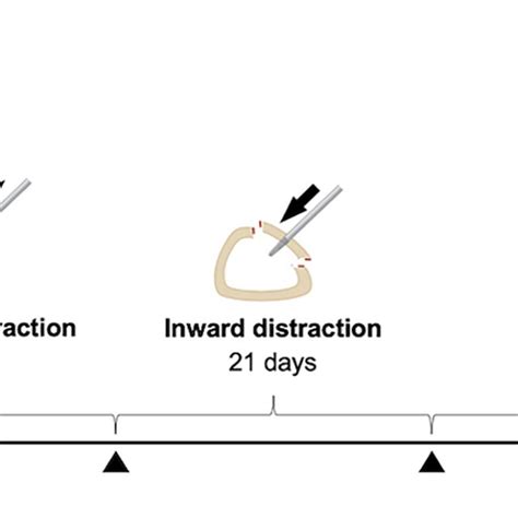Schematic Drawing Of The Management For Tibial Cortex Transverse Download Scientific Diagram