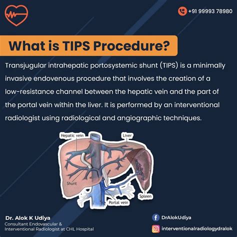 Tips Procedure