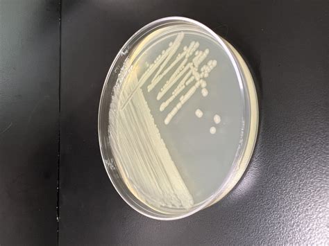 Pseudomonas Putida