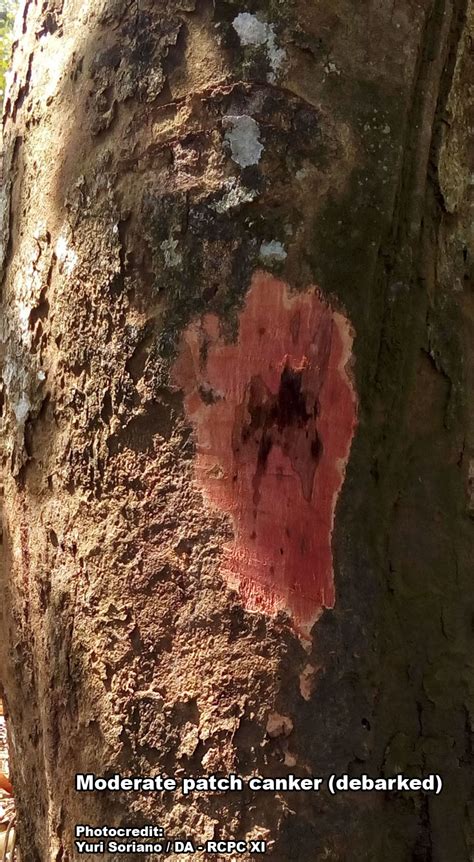 Algorithm What Is The Best Feature Detector And Descriptor Extractor To Use For Disease