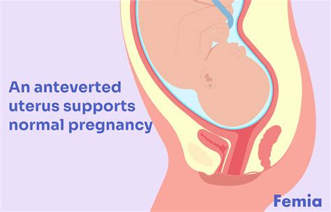 Anteverted Uterus Understanding Its Impact On Fertility And Pregnancy