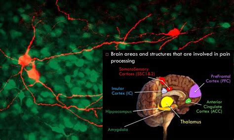 Insular Cortex Process Strong Feelings As Fear Or Bodily Discomfort