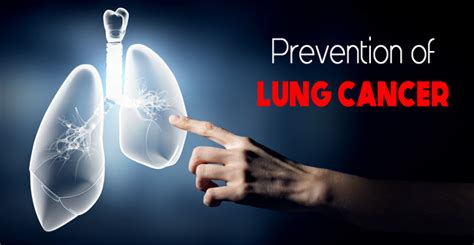 Lung Cancer Prevention