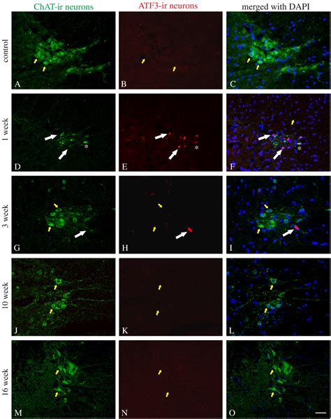 Transection Of Preganglionic Axons Leads To Cns Neuronal Plasticity Followed By Survival And