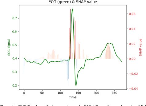 Figure 4 From Multimodal Deep Learning For Ecg Heartbeat Classification