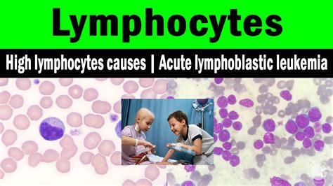Medi Lab Zone 💥💥lymphocytes High Lymphocytes Causes Acute