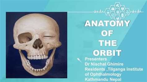 Anatomy Of The Bony Orbit Pptx