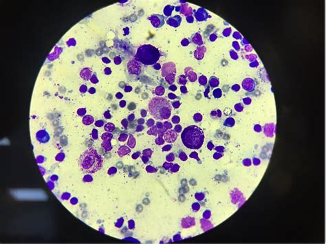 Sentinel Lymph Node In Pets Faq Understanding And Care Aura Veterinary