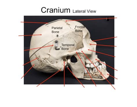 Cranium Lateral View Quiz — Printable Worksheet