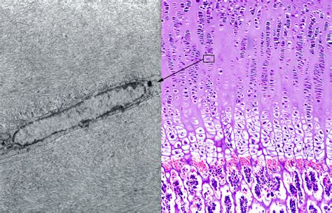 Bone Growth Plate Light Micrograph And Tem Stock Image C0610072