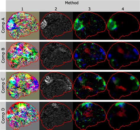 results of four independent components classified as neuronal activity