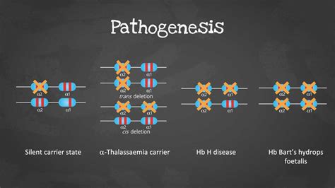 Alpha Thalassemia Causes Symptoms Diagnosis And Treatment