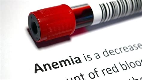 Penting Kode Icd 10 Hamil Dengan Anemia Berdasarkan Penyebabnya