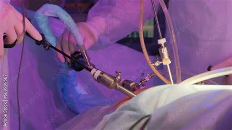 Laparoscopic Cholecystectomy Instruments At Amelia Woodhouse Blog