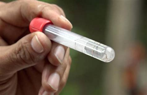 Minsa Reporta 3521 Casos Acumulados De Dengue