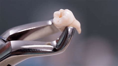 Types Of Dental Forceps And Their Uses At Annie Geil Blog