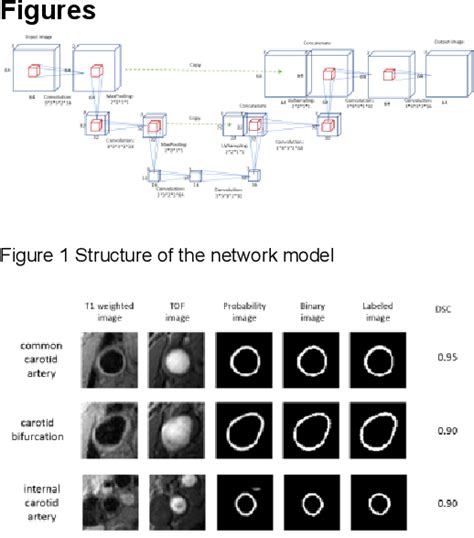 Figure 1 From Automatic Segmentation Of Carotid Vessel Wall Using Convolutional Neural Network