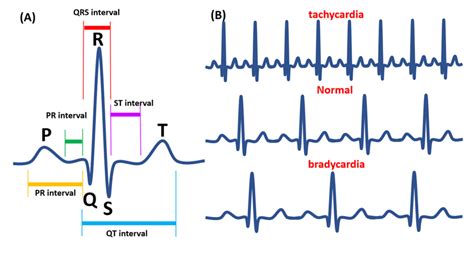 The Electrocardiography Ecg Waveform In Adult Zebrafish A The The Electrocardiography Ecg Waveform In Adult Zebrafish A The