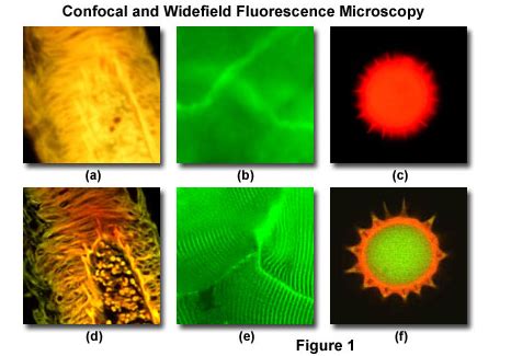 Confocal Techniques Institute For Molecular Bioscience University