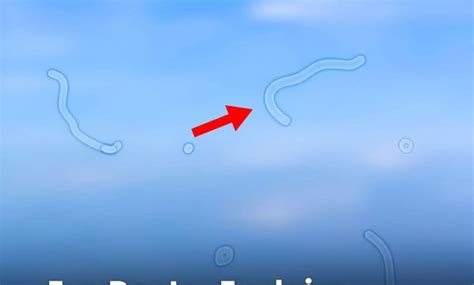 What Are Eye Floaters Here What To Do If You Start Seeing Them