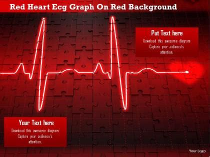Ecg PowerPoint Presentation And Slides SlideTeam