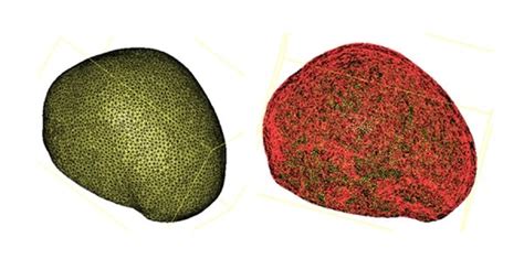 3d Finite Element Model Of Cranial Cavity Is Meshed Download