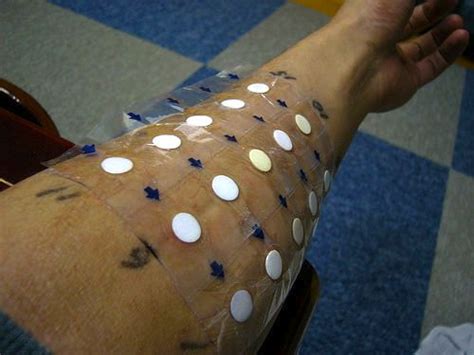 Allergic Skin Patch Testing May Help Pinpoint Allergens