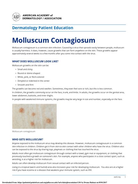 Molluscum Contagiosum Patient Uk Arau