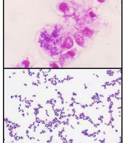 Rhodococcus Equi Flashcards Quizlet