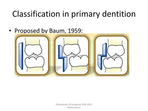Classification Of Malocclusionpptx