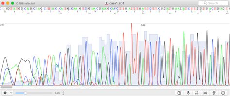 Bioedit Seq File From Sequence Caqwephones