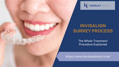 Invisalign Surrey Process The Whole Treatment Procedure Explained