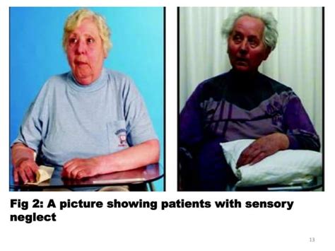 Unilateral Spatial Neglect Ppt