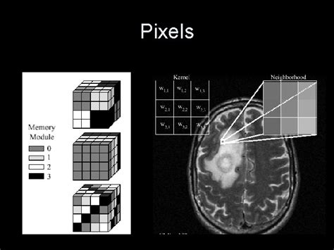 Computed Radiography Objectives Historical Perspectives Of Computerized