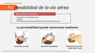 Anestesiologia Manejo Via Aerea Y Anatomia Pptx