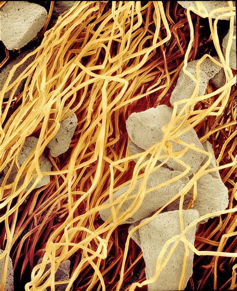 Cigarette Filter Sem Stock Image M3700892 Science Photo Library