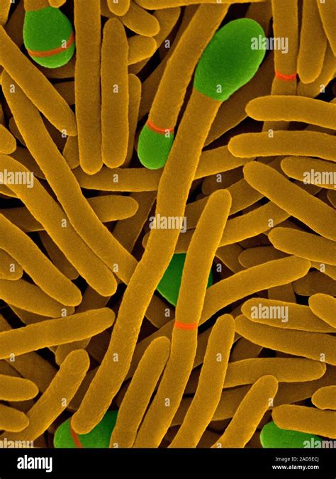 Coloured Scanning Electron Micrograph Sem Of Clostridium Phytofermentans Gram Positive