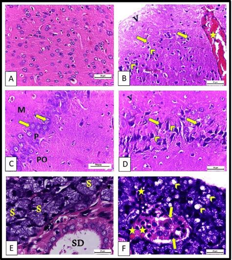 Sections Of The Cerebral Cortex Hippocampus X400 And Submandibular