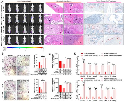 Mettl3 And Ythdf1 Anln Axis Promotes Hcc Bm A Representative Bli