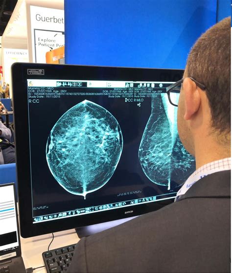 Pacs Medical Imaging Software Pacs And Radiology Software Solutions